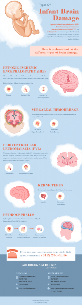 Infant Brain Damage | Milwaukee Birth Injury Attorney